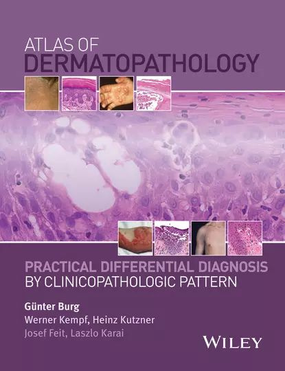 Atlas of Dermatopathology | Kutzner Heinz, Burg Gunter | Электронная книга - купить с доставкой ...