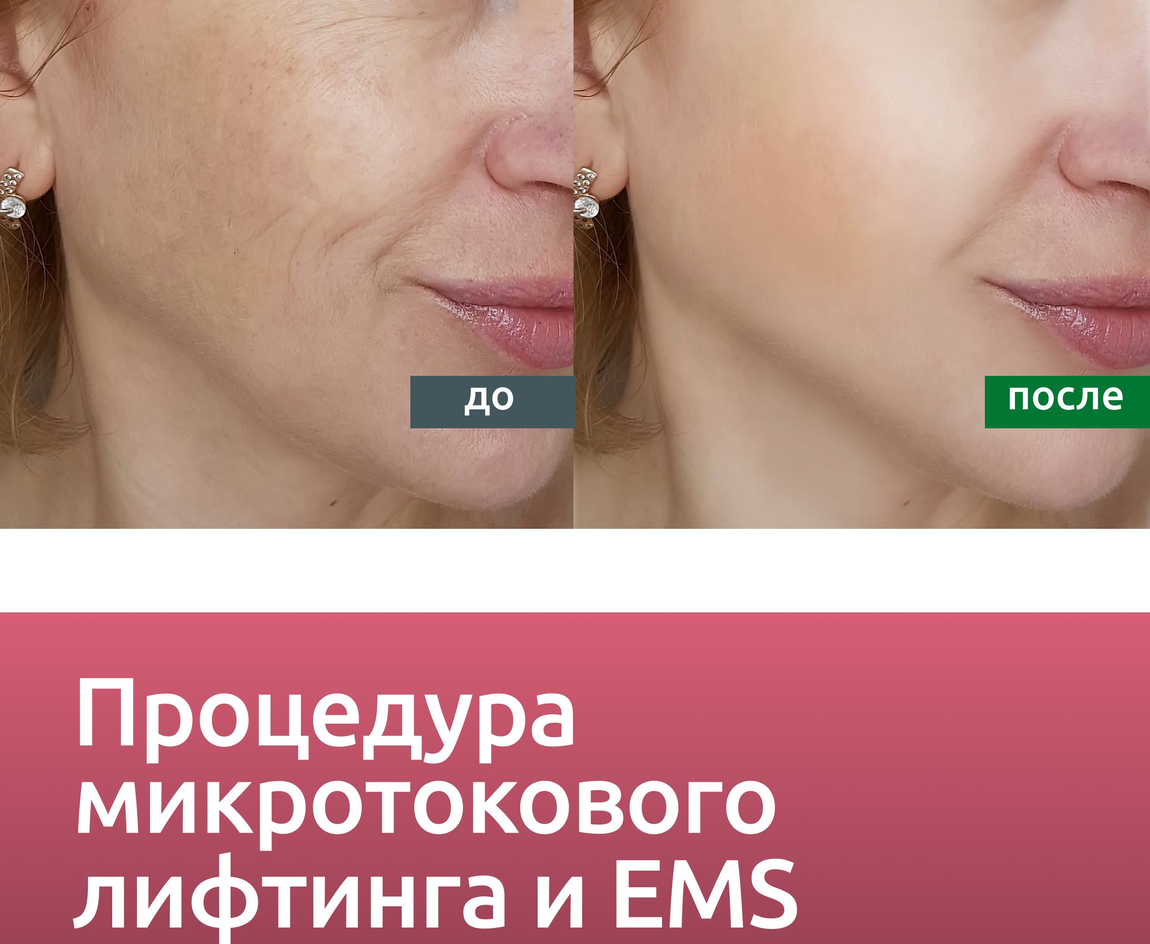 Readyskin Care Lifting Gel / Контактный токопроводящий гель для ...