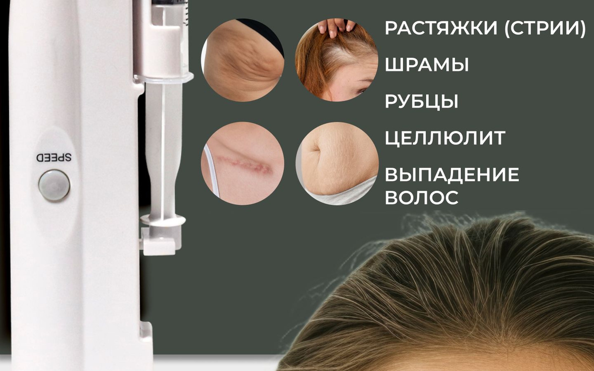 Мезотерапия Электрический мезороллер / Аппарат для фракционной ...