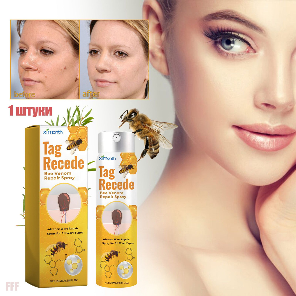 20ML Tag Recede Bee Venom, Средство от папиллом и бородавок, мазь для ...