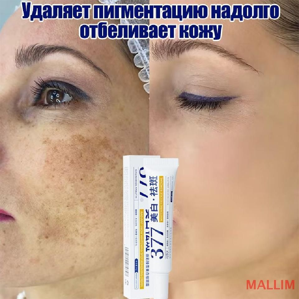 крем против пигментных пятен и веснушек с Витаминами С и Е и