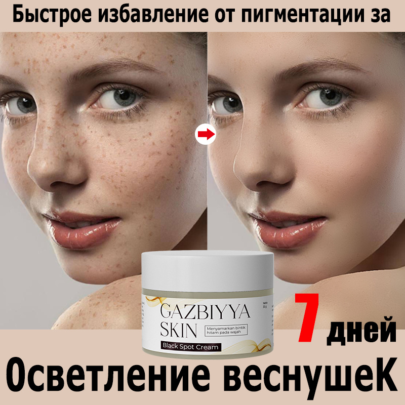 крем против пигментных пятен и веснушек с Витаминами С и Е и Гиалуроновой кислотой Средство