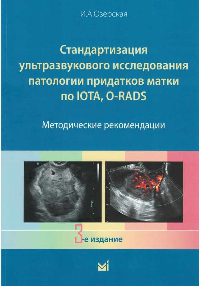 Стандартизация ультразвукового исследования патологии придатков матки ...