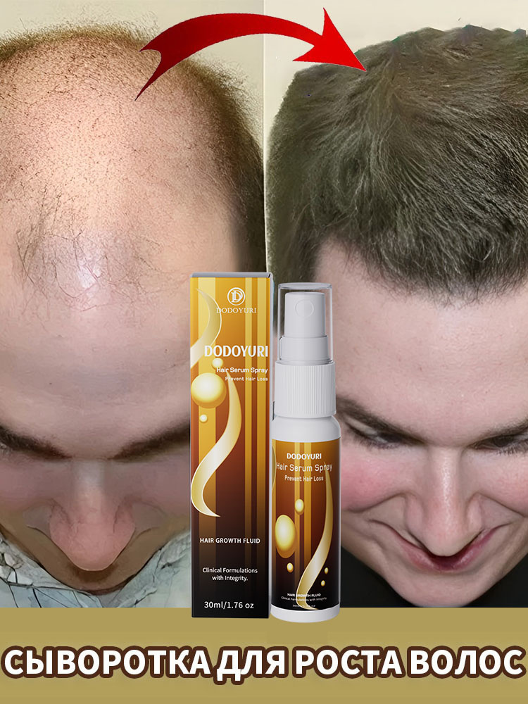 DODOYURI Мощный для роста волос спрей для роста волос,Профессиональное ...