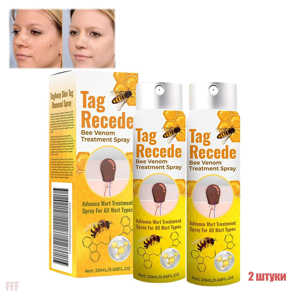 40ML Tag Recede Bee Venom, Средство от папиллом и бородавок, мазь для ...