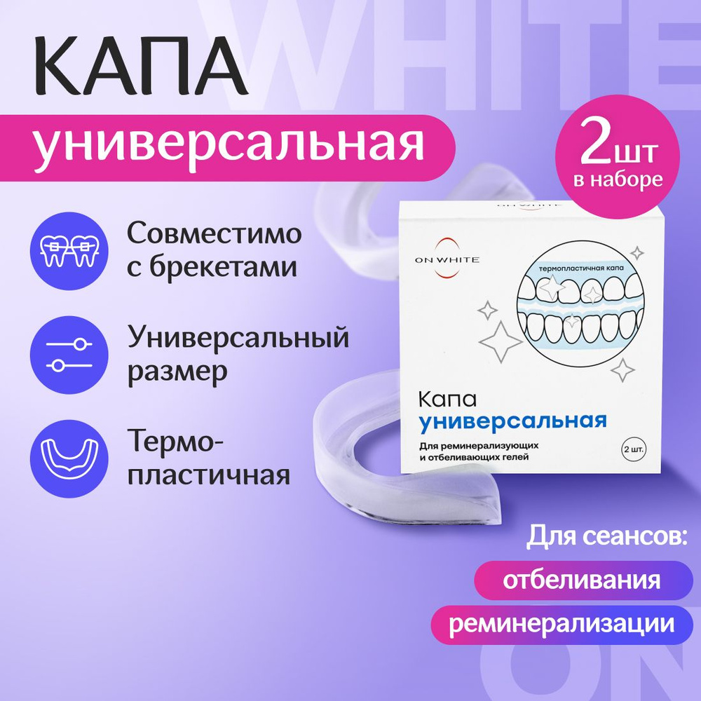 ON WHITE / Капа стоматологическая для отбеливания зубов и ...