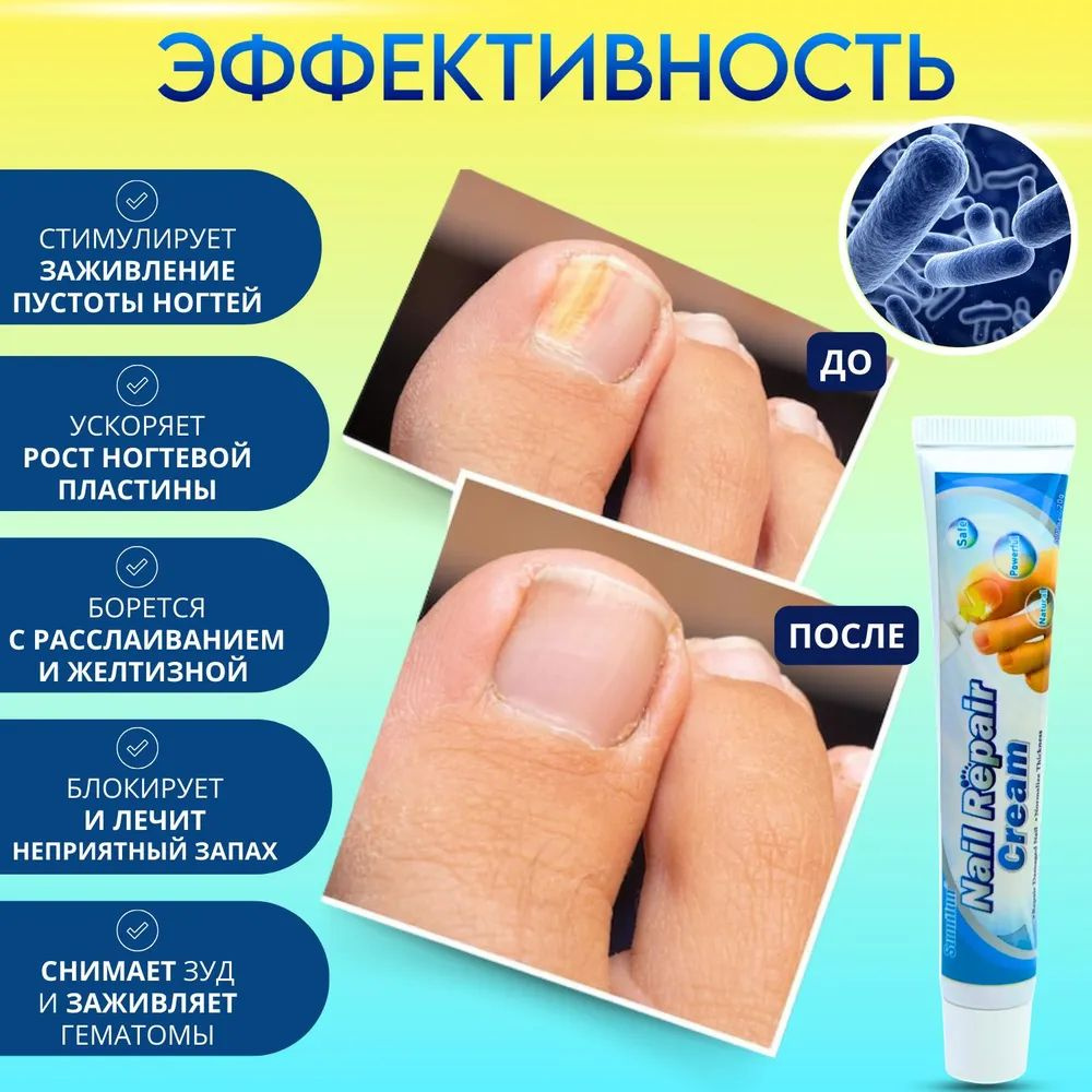 Средство от грибка ногтей, Китайская ЧУДО МАЗЬ 2 шт. - купить с ...