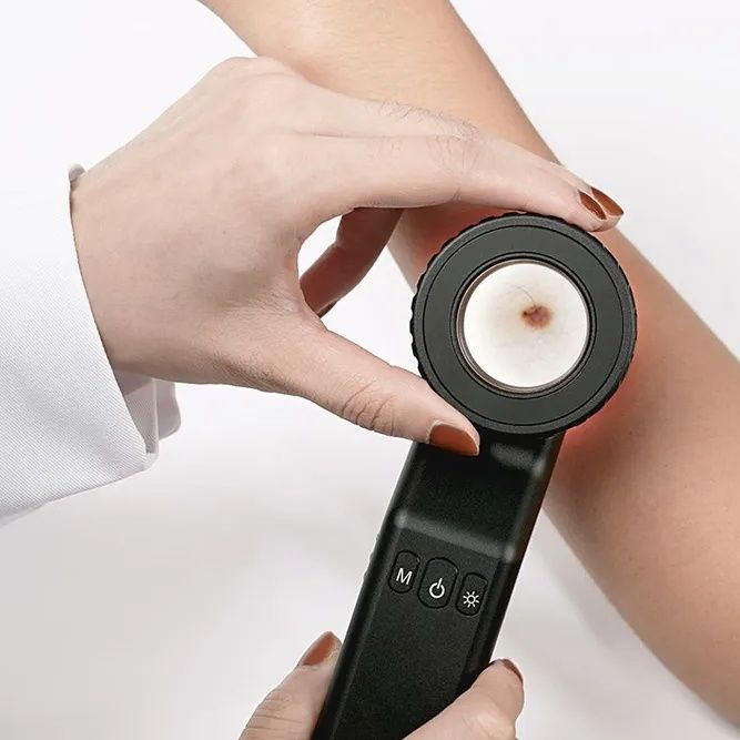 IBOOLO DE-4100 Дерматоскоп 10X Magnify Macro Zoom Lens для дерматологической диагностики ...