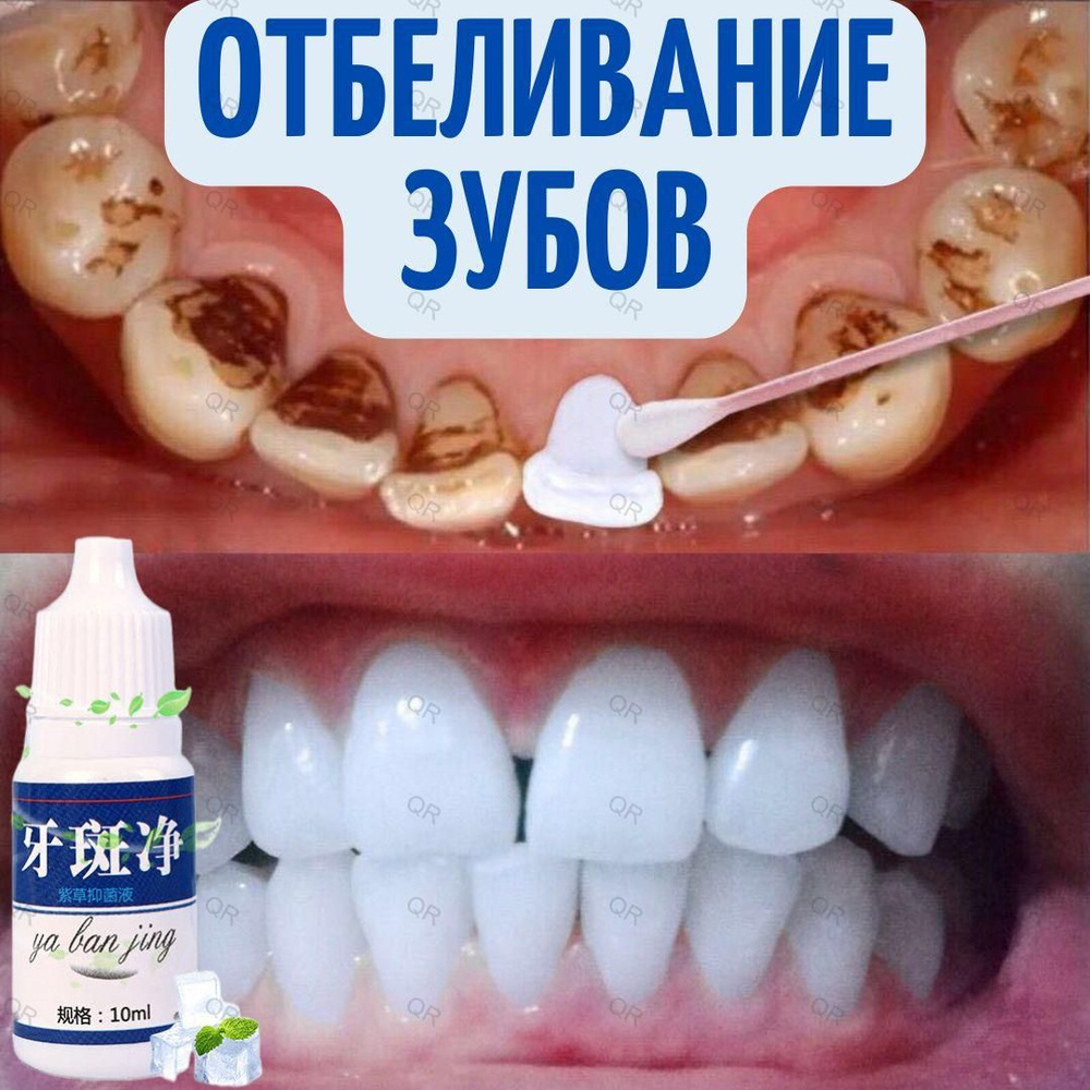 Отбеливание зубов Ya Ban Jing. Средство для чистки и отбеливания зубов ...