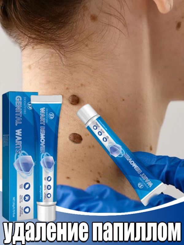 DODOYURI / Мазь от бородавок, Крем средство для удаления бородавок ...