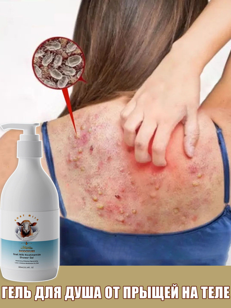DODOYURI Гель для душа против акне и прыщей профессиональный с ...