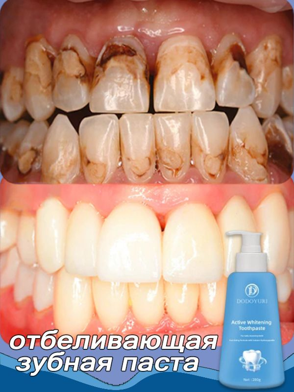 DODOYURI Зубная паста отбеливающая гелевая с дозатором/против кариеса ...