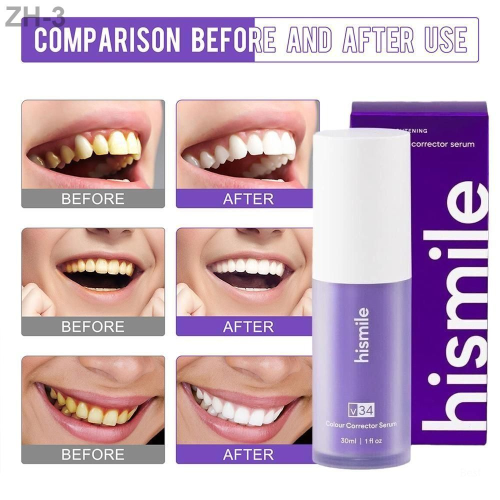 Hismile V34 Фиолетовый отбеливатель для зубов, удаление пятен 30 мл ...