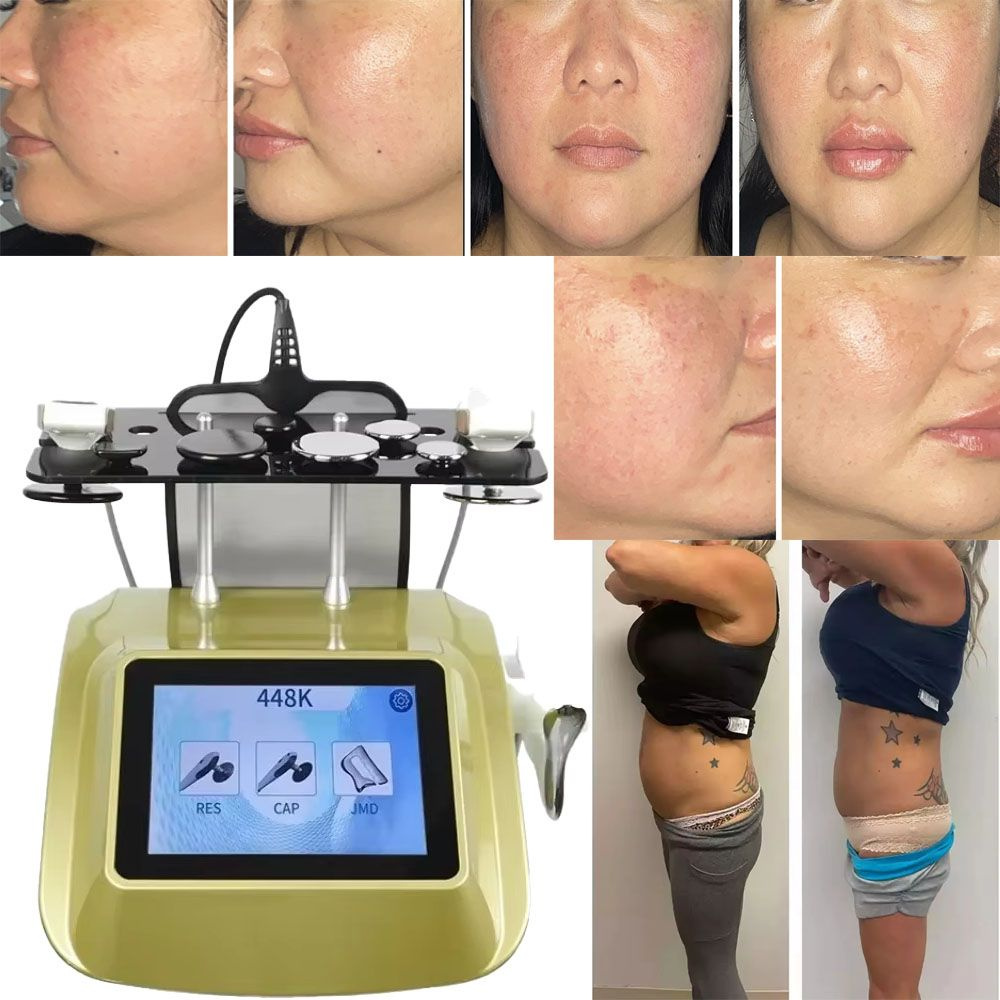 Аппарат RET CET RF 448 kHz (3 в 1) Индиба Indiba купить на OZON по ...