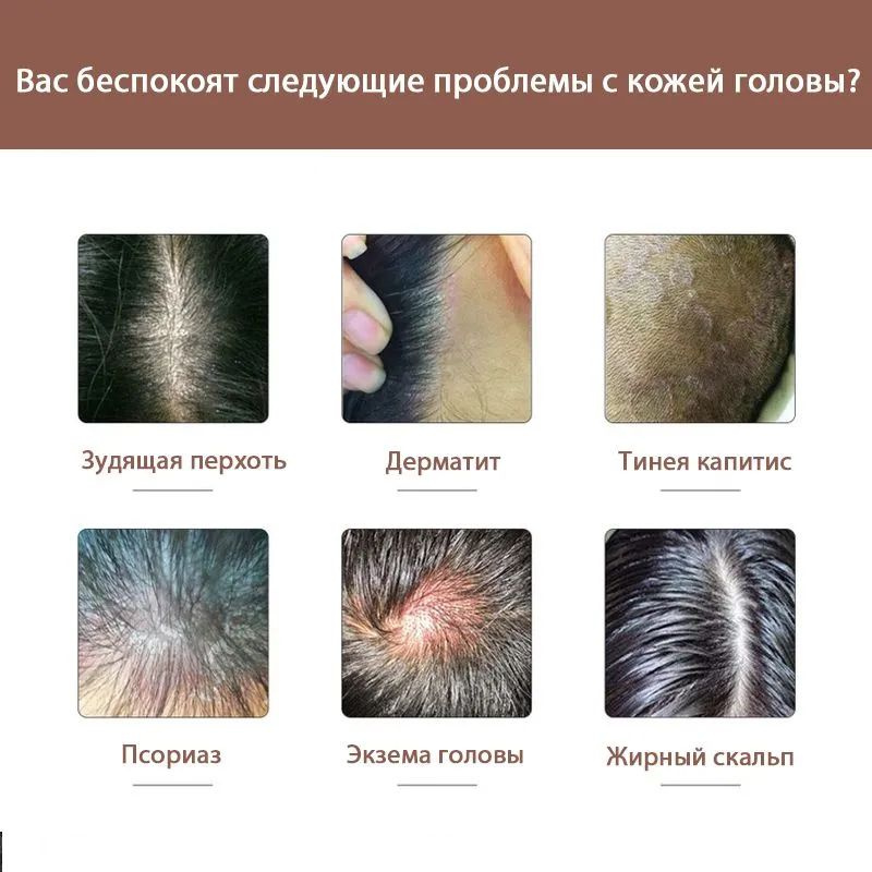 DODOYURI Интенсивный шампунь против перхоти,лечебный, от себореи, от ...