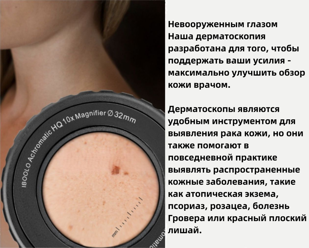IBOOLO DE-400 Дерматоскоп 10X Magnify Macro Zoom Lens для дерматологической диагностики - купить ...