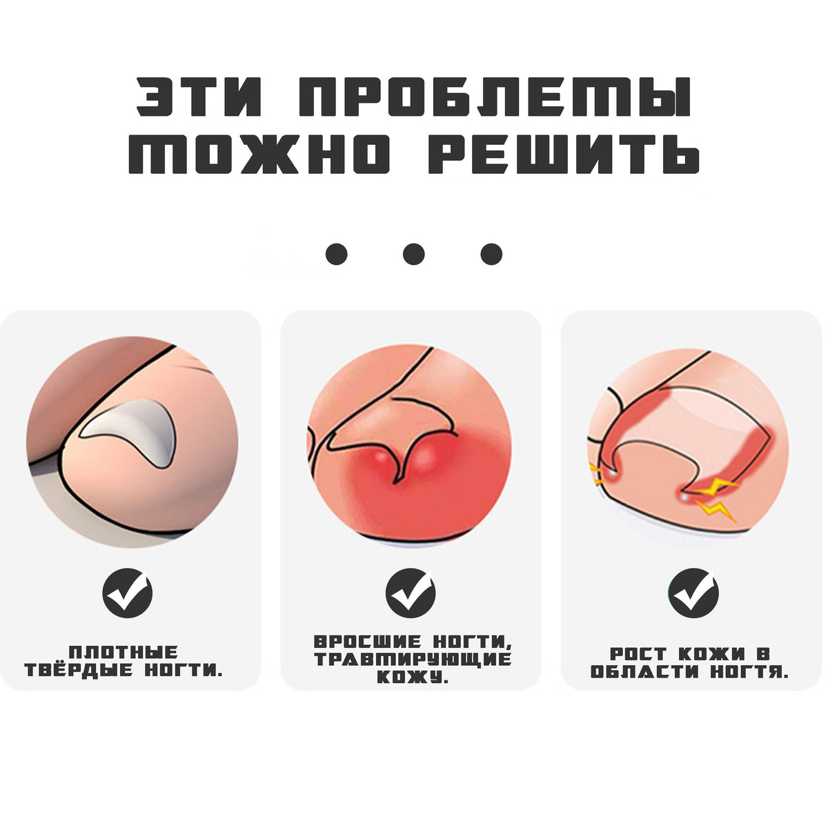 кусачки для ногтей,кусачки для ногтей на ногах,удобны для стрижки в ...