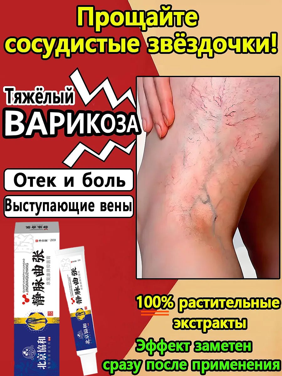 Чудо мазь от варикоза и усталости, крем натуральный для ног и вен ...