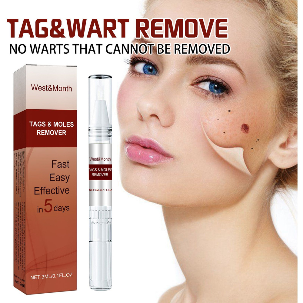 West&Month Wart Removal Pen, для удаления бородавок, папиллом и родинок ...