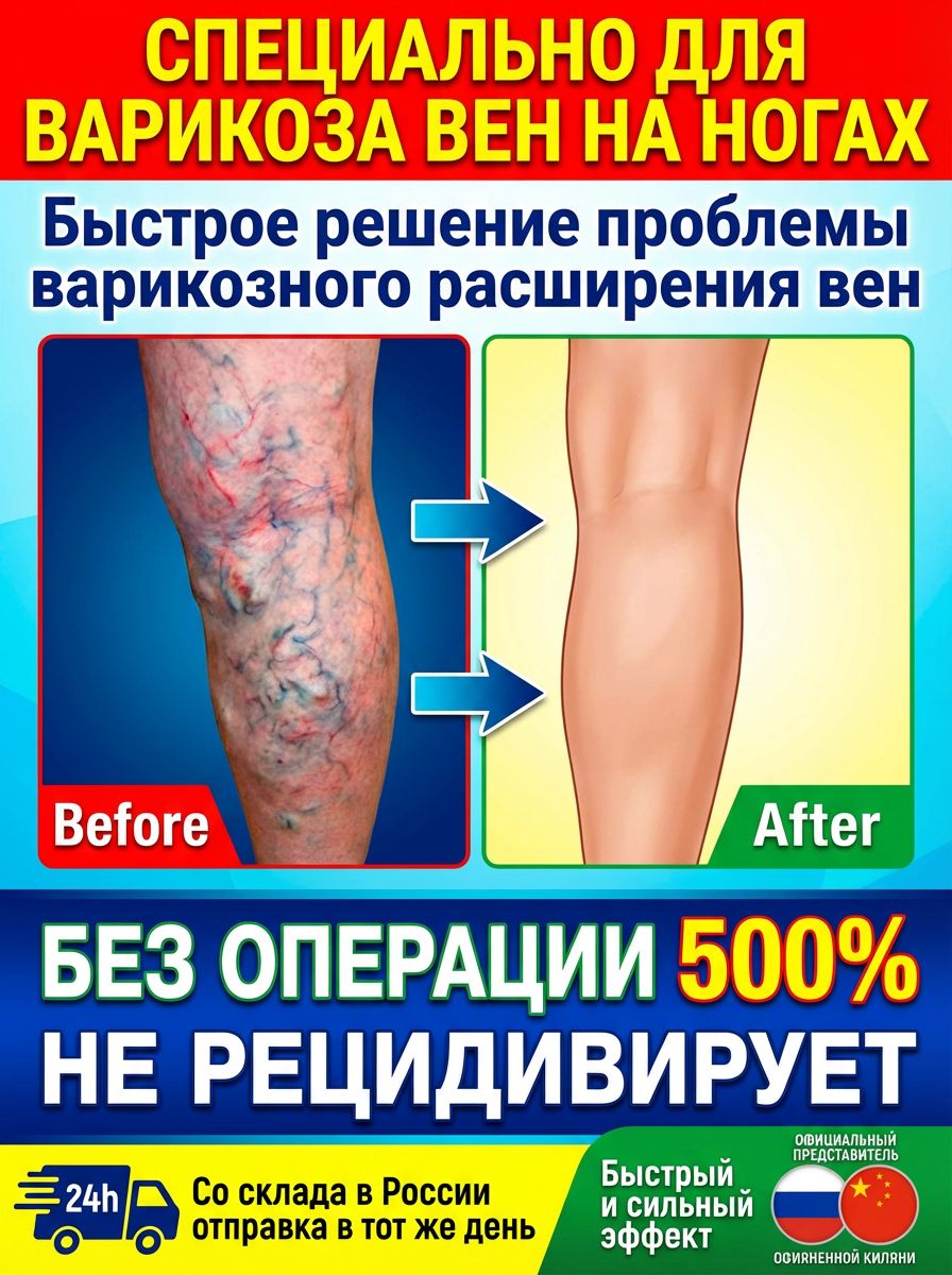 Чудо мазь от варикоза и усталости 2шт, крем натуральный для ног и вен ...