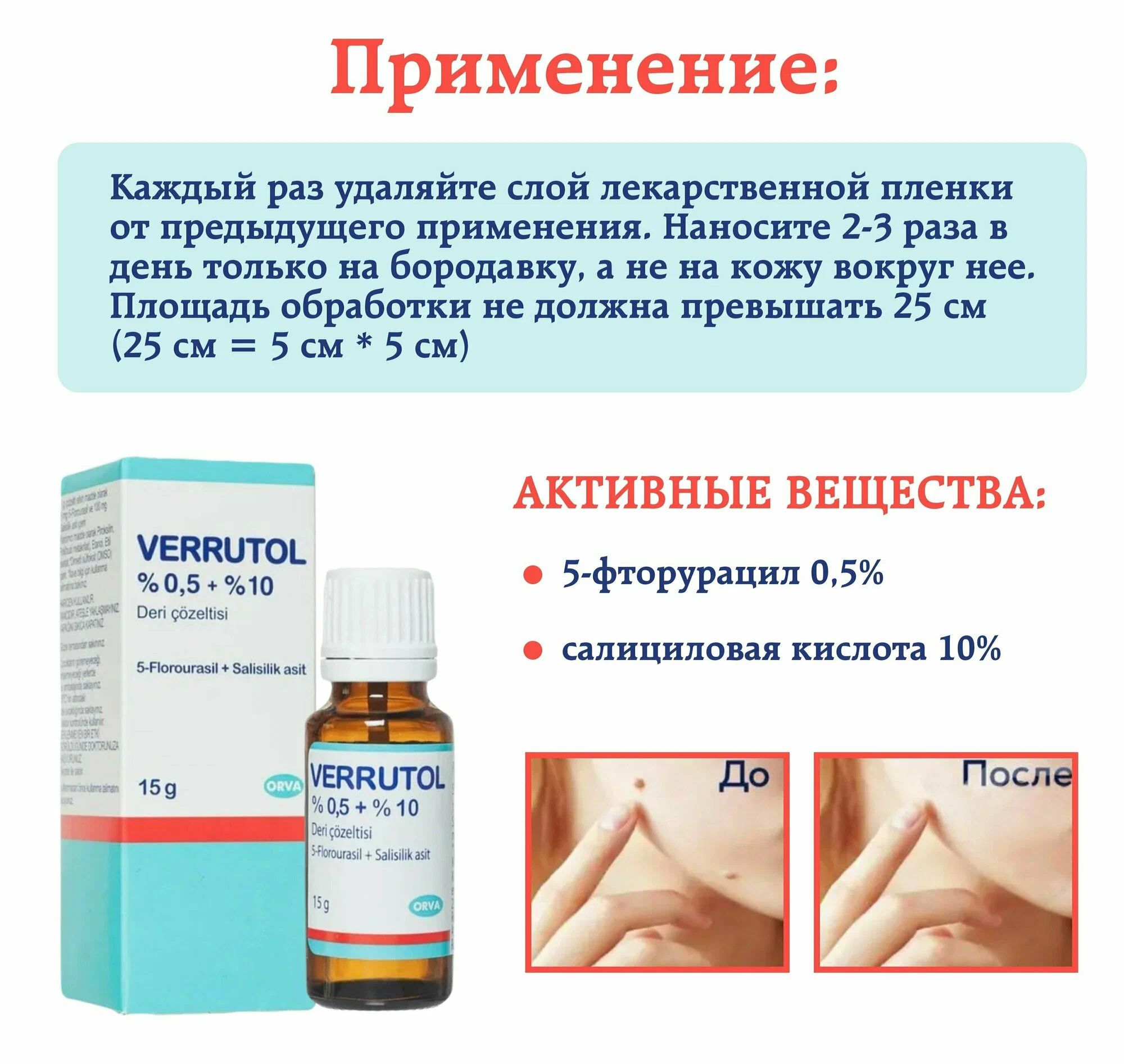 VERRUTOL Веррутол растор на бородавке в бородавке. 15 мл. купить на ...