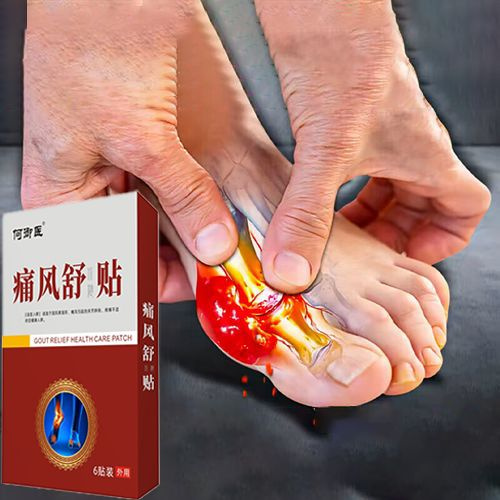 Профессиональные пластыри от подагры, для лечения подагры, вальгусной ...