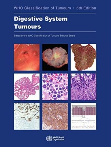 Who Classification of Digestive System Tumours. 5 ed купить на OZON по ...