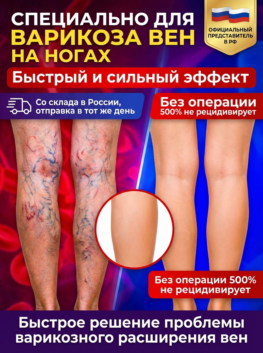 Чудо мазь от варикоза и усталости 2шт, крем натуральный для ног и вен ...