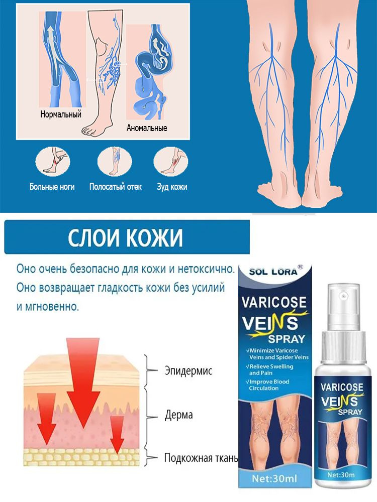 SOL LORA Спрей от варикоза, усталости и отека ног 30ml Эффективно лечит отек и боль в ногах ...