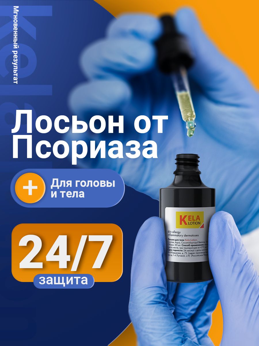 Лосьон от псориаза Kela Lotion / Средство от дерматита, от экземы, от ...