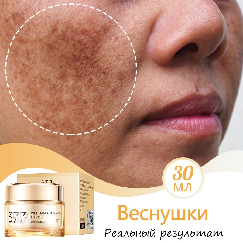 377 Крем для удаления темных пятен для отбеливания веснушек 30мл ...