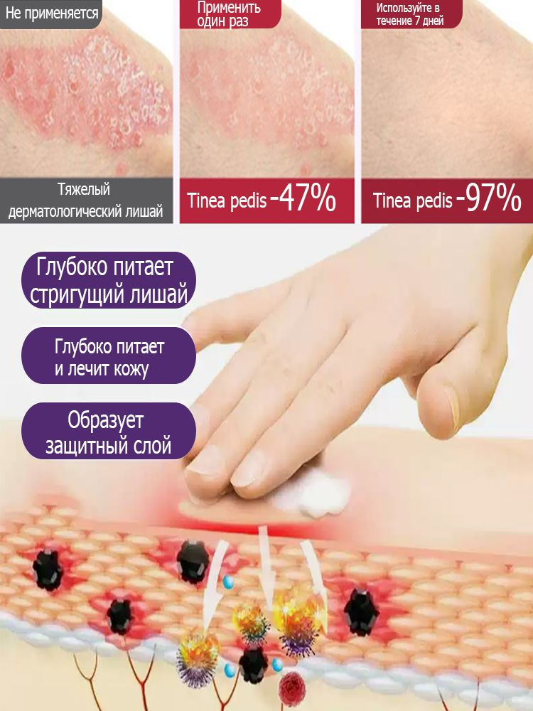 DODOYURI Крем чудо китайский от псориаза и дерматита 60 г,При экземе ...