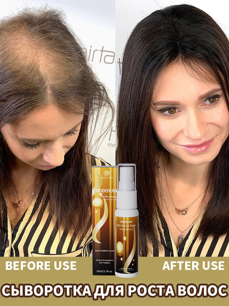 DODOYURI Мощный для роста волос спрей для роста волос, натуральной ...