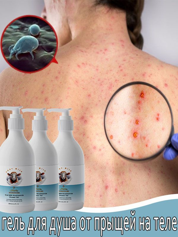 DODOYURI Гель для душа от прыщей, акне и пигментных пятен для ...