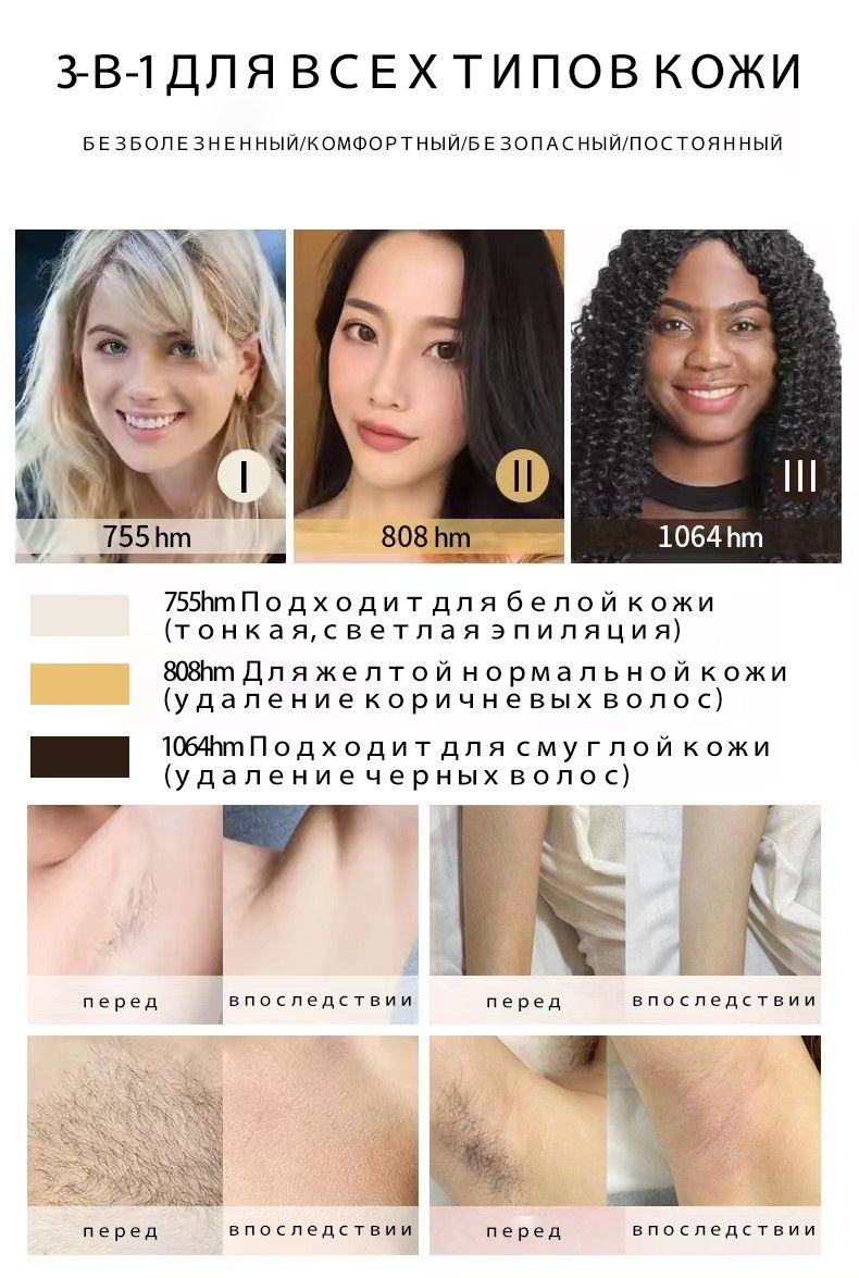 Эпилятор лазерный 808 Сопрано Лазерный элюирующий аппарат «все в одном» купить на OZON по низкой ...