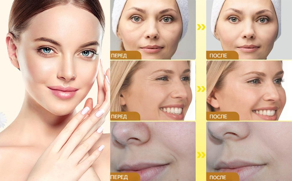 2025 Ботокс Bee Venom Rinkle Cream, Bee Venom Укрепляющий крем против ...