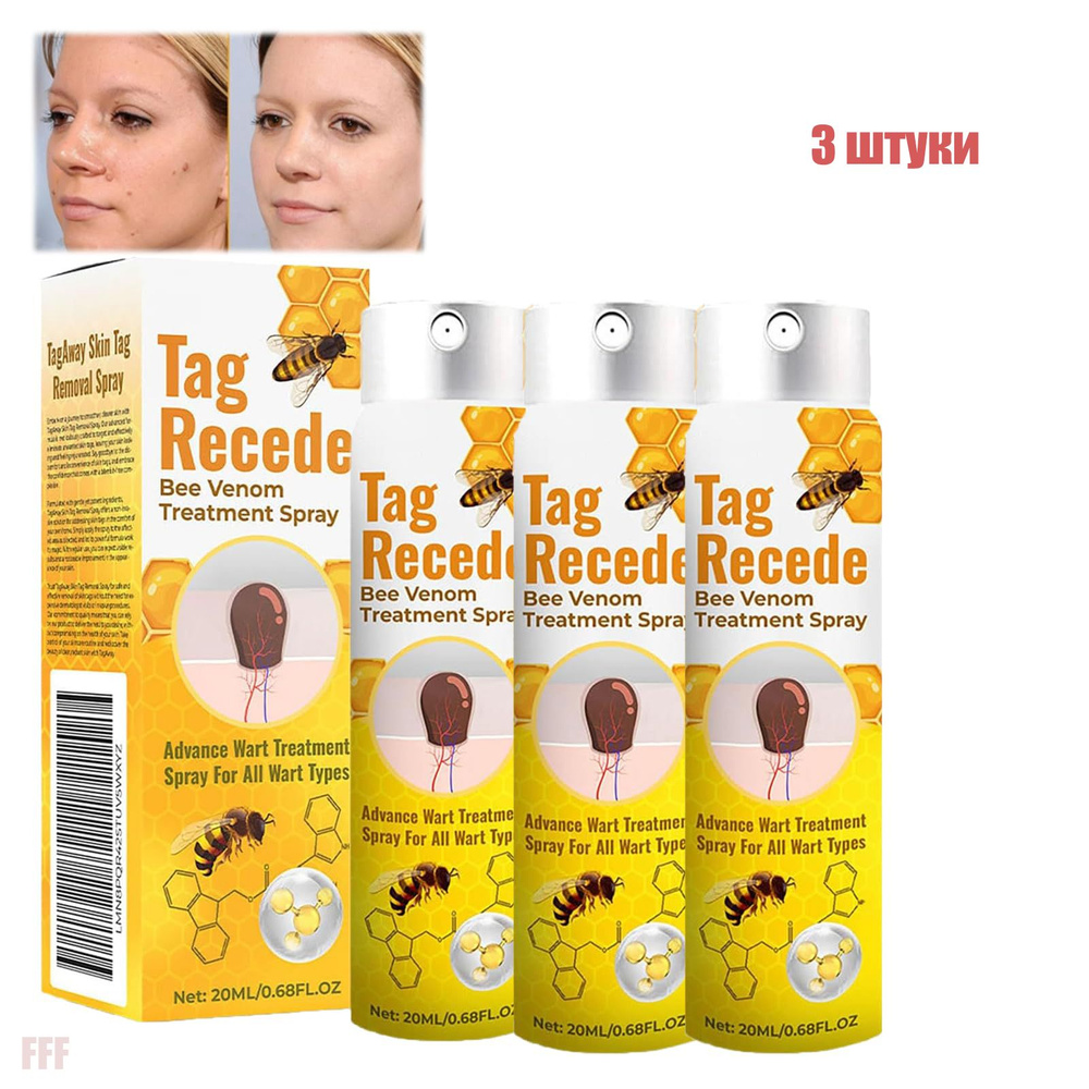 60ML Tag Recede Bee Venom, Средство от папиллом и бородавок, мазь для ...