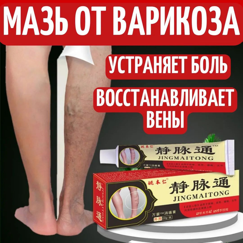 Китайская мазь от варикоза вен на ногах Джинг Май Тонг купить на OZON ...