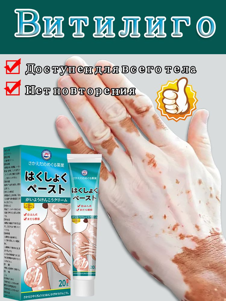 Крем для удаления витилиго 20 г для восстановления пигментации при гипопигментации разноцветном