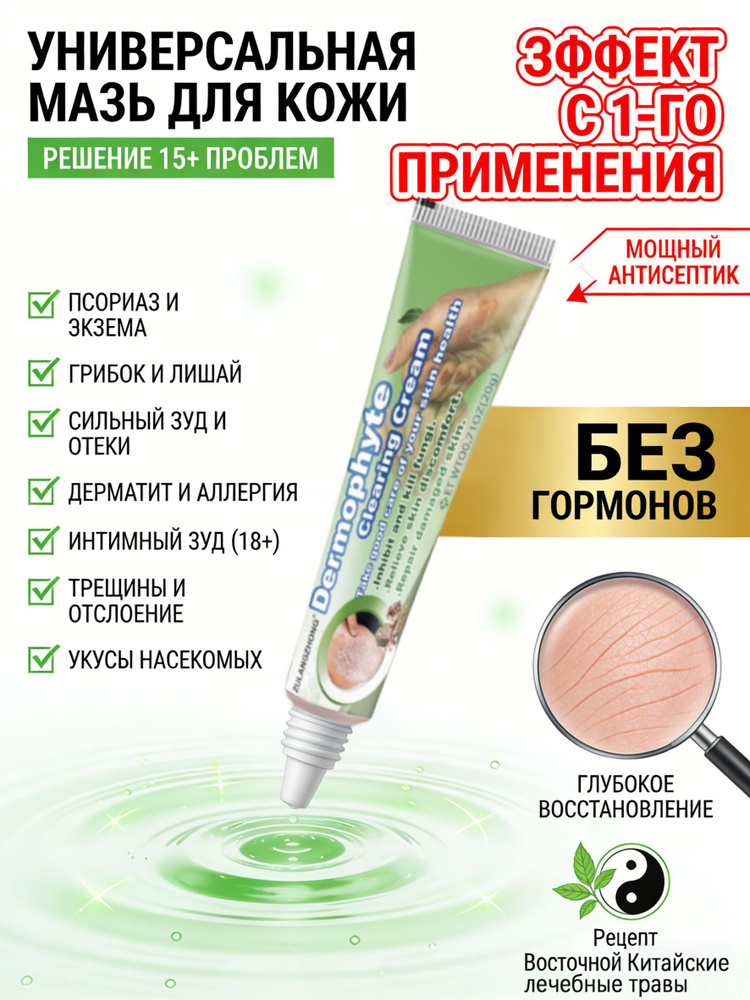 Мазь от зуда, псориаза и экземы / Крем от дерматита и шелушения ...