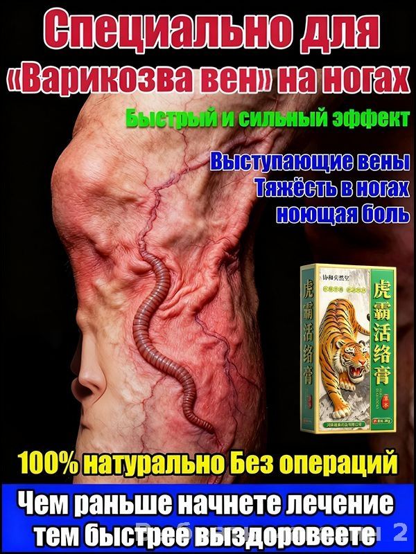 Натуральный крем венотоник для ног от варикоза и усталости, китайская ...