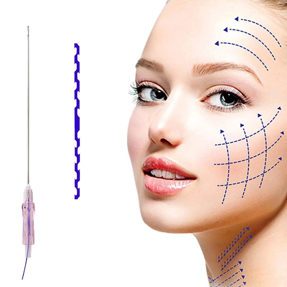 Шприц Мезонити в канюле Мезонити для косметологии (PDO mono/screw ...