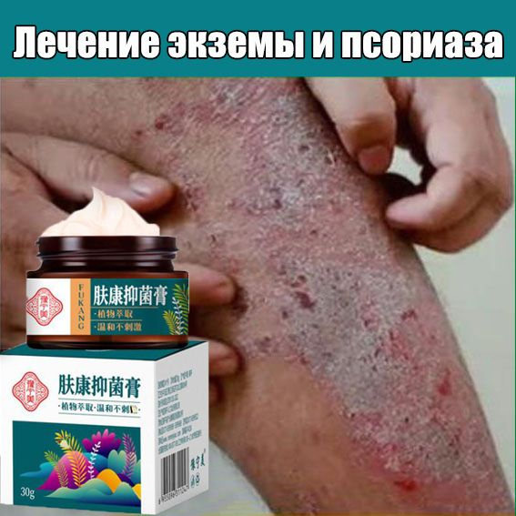 Мазь от псориаза / Крем антибактериальный для кожи / 30g При псориазе ...