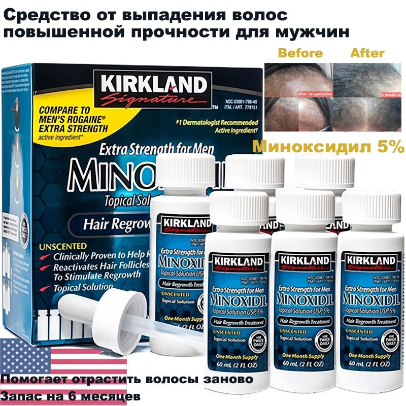 Kirkland Minoxidil Signature Концентрат для волос, 360 мл - купить с ...