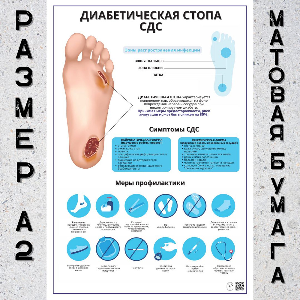 Плакат "Диабетическая стопа" - купить с доставкой по выгодным ценам в ...