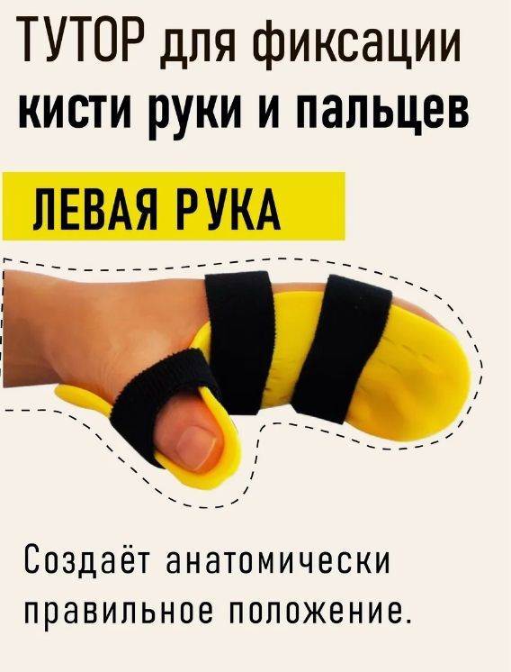 Держатель для ладонной шины справа: Реабилитационный Ортез после ...