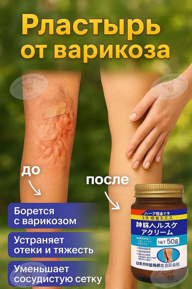 мазь от варикоза, венотоник от отеков и тяжести в ногах,Эффективен при ...