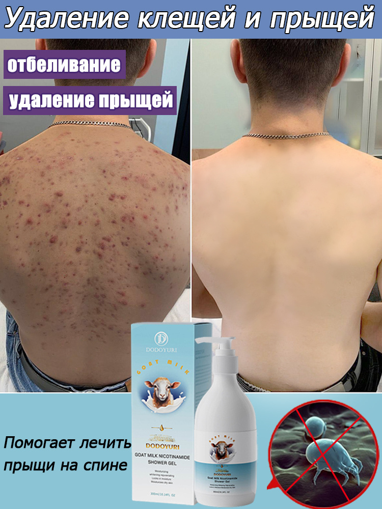 DODOYURI отбеливание Гель для душа от прыщей,300 мл, Гель для душа от ...