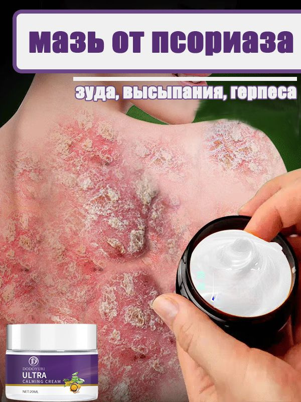 DODOYURI мазь от псориаза/ Китайская мазь 30 r купить на OZON по низкой ...