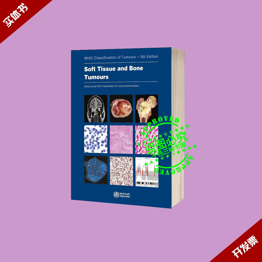 Soft Tissue and Bone Tumours: WHO Classification of Tumours (Medicine ...